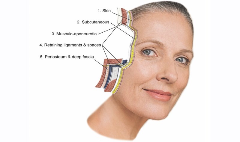 Deep plane facelift Amsterdam Netherlands | Face Institute